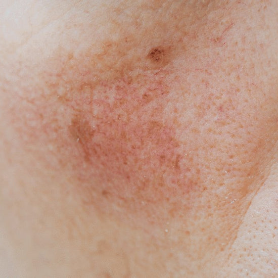 Husk & Seed Skincare | 100% Natural Botanical Skincare Products UK